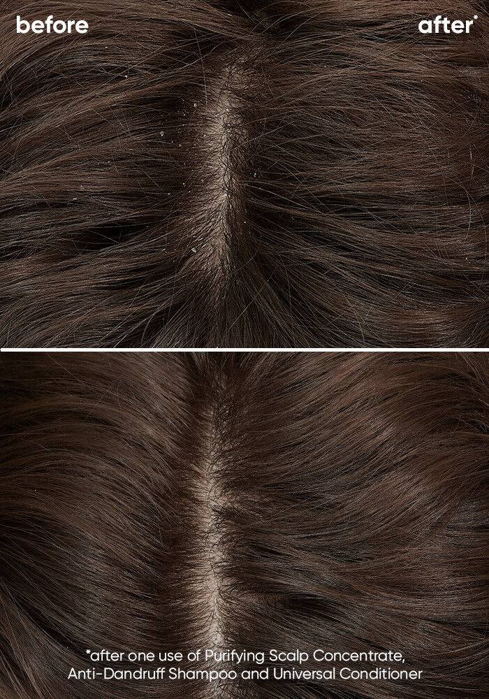 Biolage Scalp Sync Purifying Scalp Concentrate